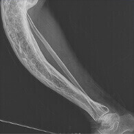 Pantoflex ครีมบำรุงรักษาข้อต่อ